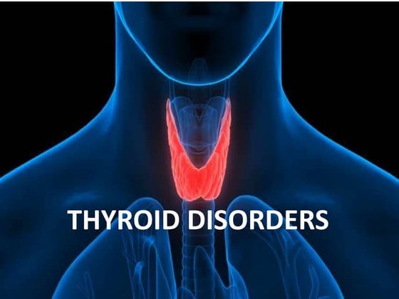 Thyroid disease- explained by Dr sunny singhal | PPTX