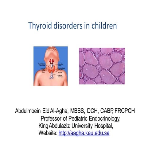 Thyroid disorders in children | PDF