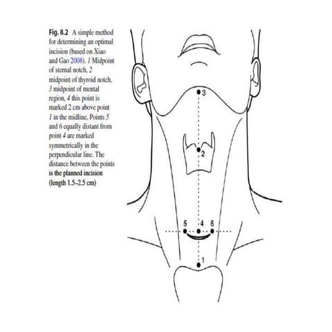 thyroidectomy notes.pptx