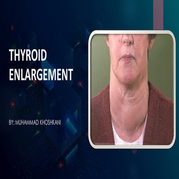 thyroid enlargment, goitre, including its types, causes, diagnosis ...