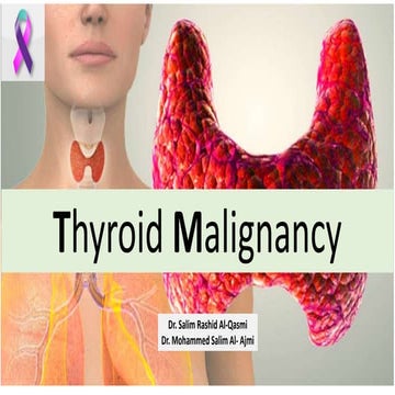 Thyroid malignancies for Medical Students | PPTX