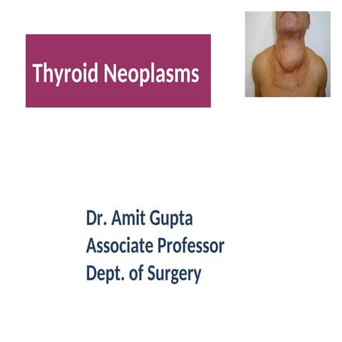 Classification of Thyroid Tumors: A Standardized Diagnostic Approach | PPT
