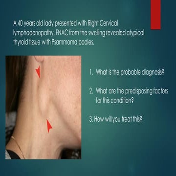 Thyroid OSCE presentation fr MBBS student | PDF