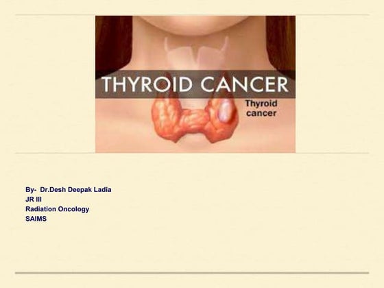 Thyroid cancer | PDF