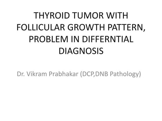 thyroid tumours.pptx