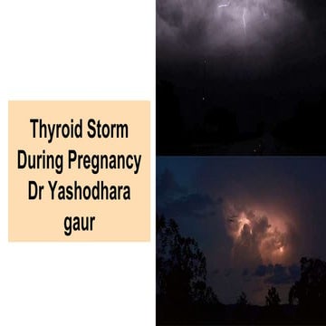Thyroid storm Dr Yashodhara Gaur | PPTX