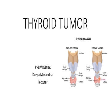 Thyroid Tumor 1 Pptx Medical Surgical Nursing Ppt