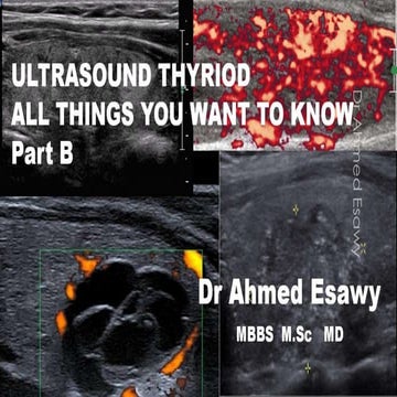 Thyroid ultrasound all things you should know part b | PPT
