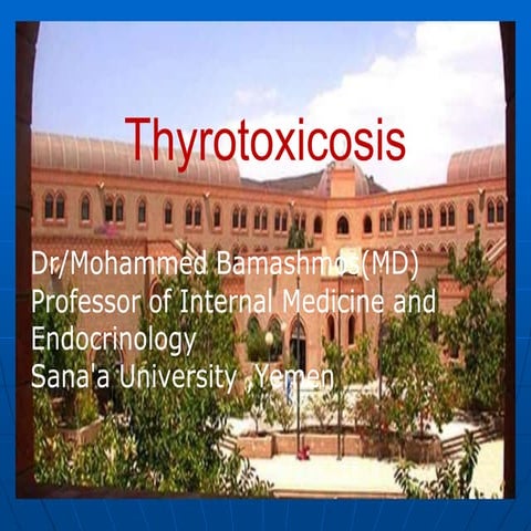 thyrotoxicosis , causes, diagnosis and treatment | PPTX