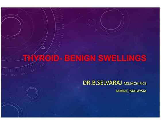 Thyrotoxicosis | PPTX