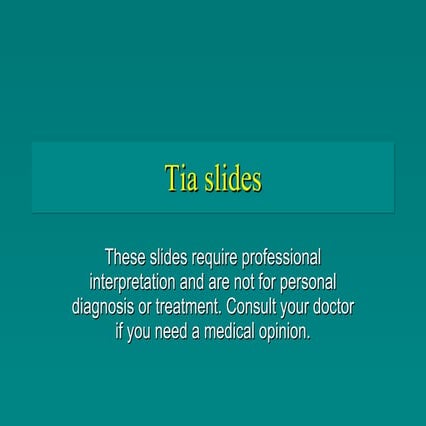 Tia | PPT