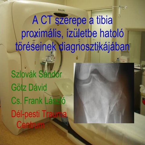 Ankle fracture and temporal talocrural fixation, power point | PPT