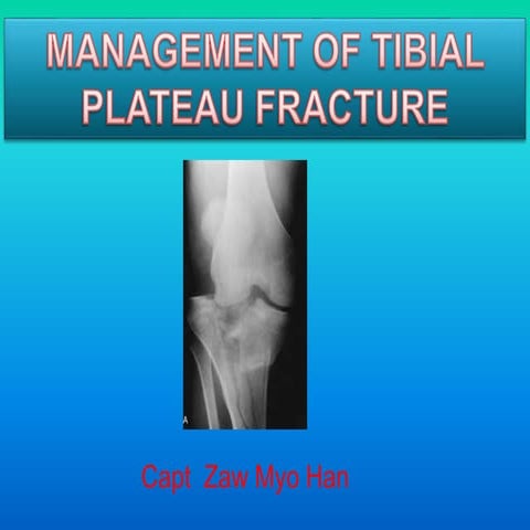 Tibial plateau fracture management .pptx