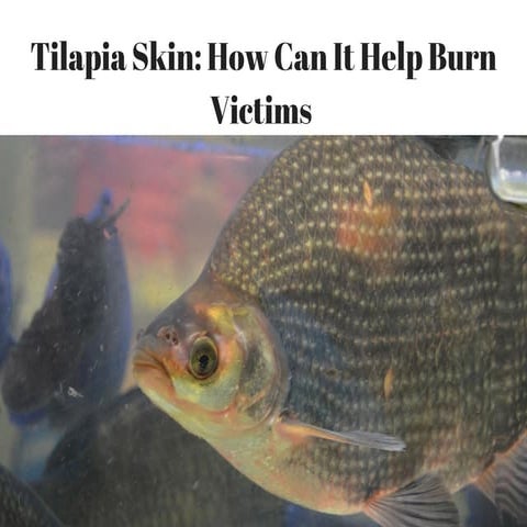 Tilapia Skin: How Can It Help Burn Victims | PDF | Skin and Dermatology ...