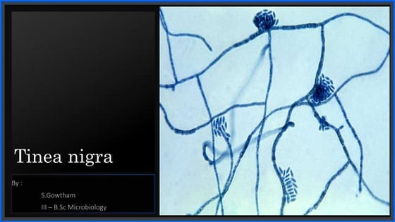 Medical Mycology Black Piedra and White Piedra.pptx