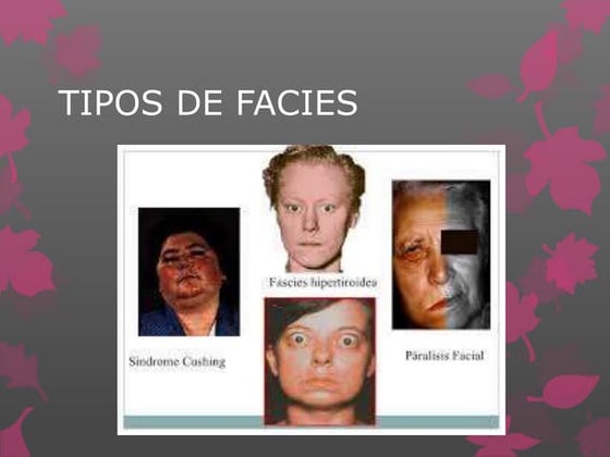 Semiologia Médica - Facies | PPTX
