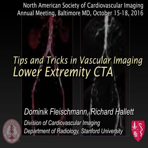 CT Lower Limb Angiography: Techniques, Indications, Protocols, Image ...