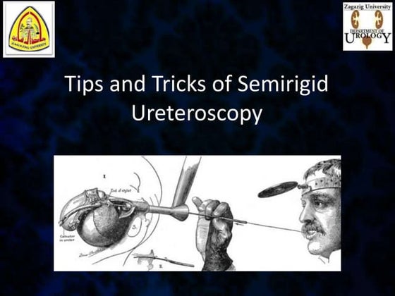 Ureteroscopic lithotripsy (URSL) | PPTX