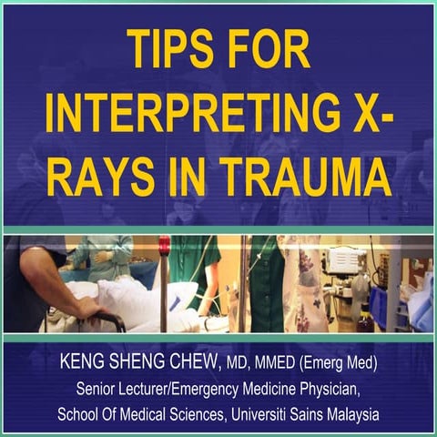 Tips for interpreting x ray in trauma | PDF