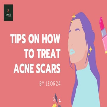 Tips on how to treat acne scars | PPTX