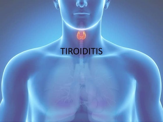 Tirotoxicosis | PPT