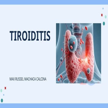 TIROIDITIS-tiroidtis autoinmune cronica o de hashimoto.pptx