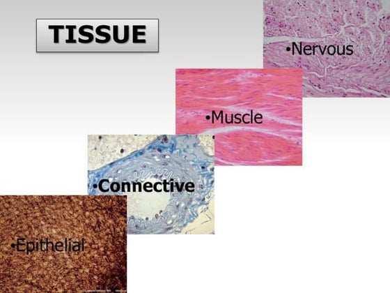 types of animal tissues class 9 | PPTX | Bone and Joint Conditions | Diseases and Conditions