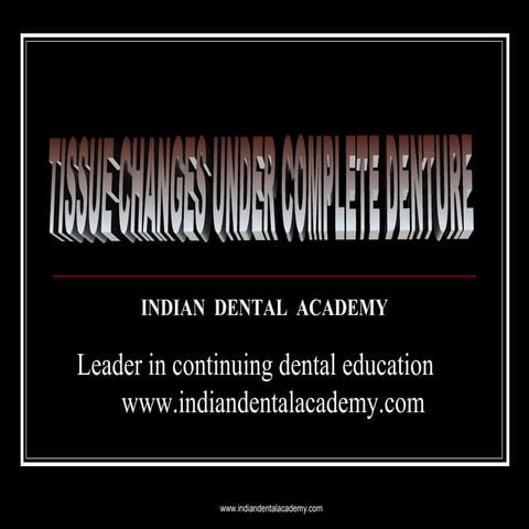 Tissue changes/ fixed orthodontics courses | PPT