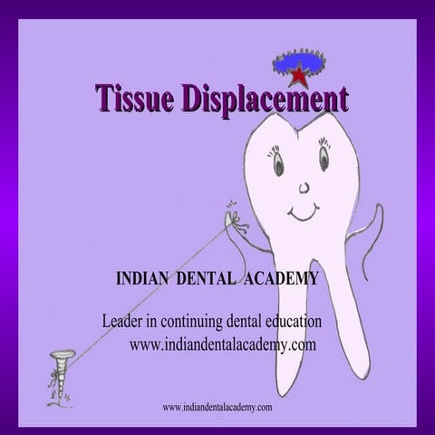 Tissue diplacement/ dentistry orthodontics | PPT