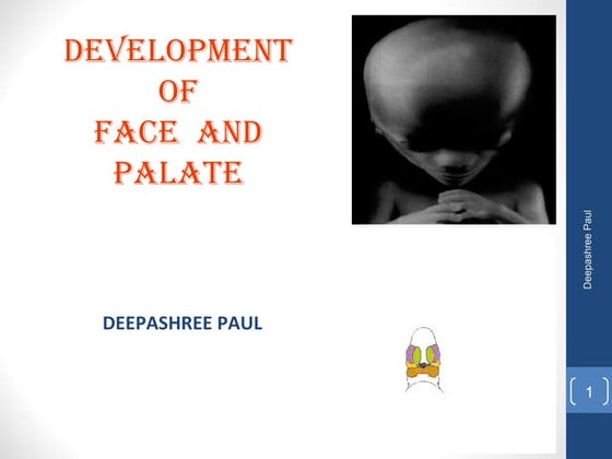 DEVELOPMENT OF FACE AND CONGENITAL MALFORMATIONS.ppt