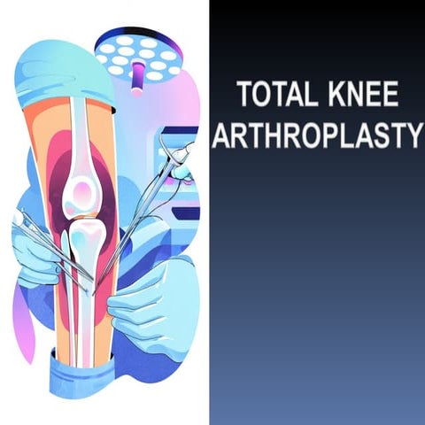 Stiff Knee after Total knee replacement. | PPTX