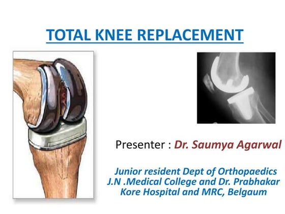 Total knee approaches | PPT