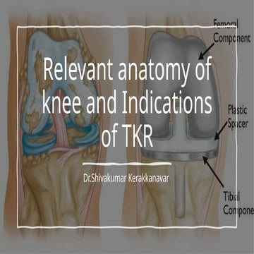 TKR for beginners arthroplasty final .pptx