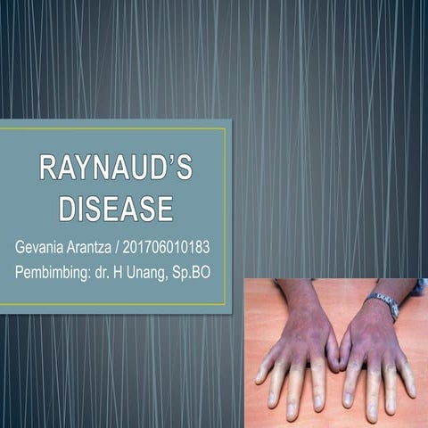 TL - Raynaud's Disease (Geva).pptx
