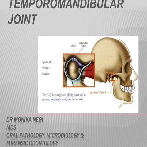 Temporomandibular Joint (TMJ ) | PPT