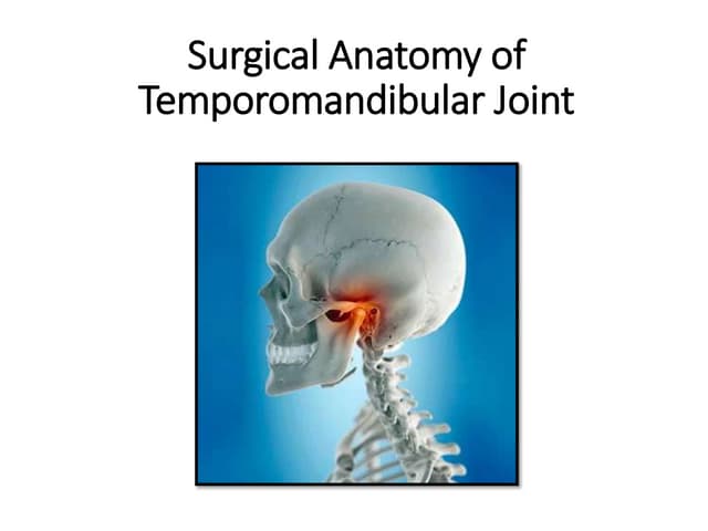Arthrocentesis of the temporomandibular joint | PPTX
