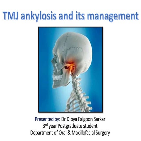 Temporomandibular joint ankylosis and its management | PPTX