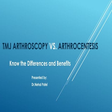 TMJ Arthroscopy vs. Arthrocentesis - Treatment for TMJ Disorder | PPTX