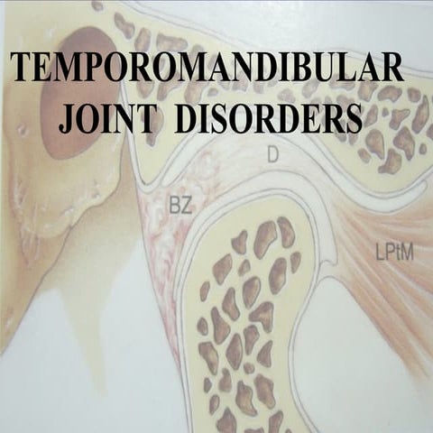 TMJOINT DISC INTERNAL DISORDERS POWERPOINT | PPT
