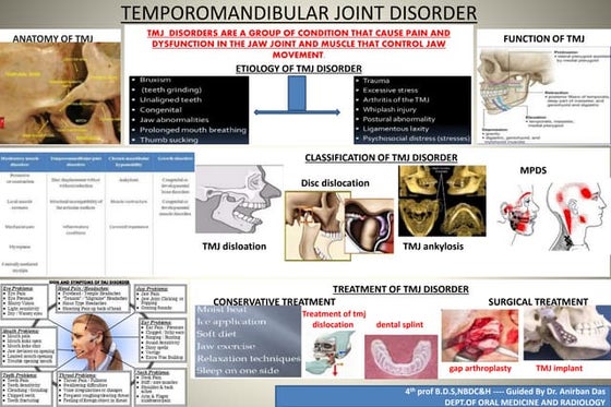 Temporomandibular joint disorder | PPT