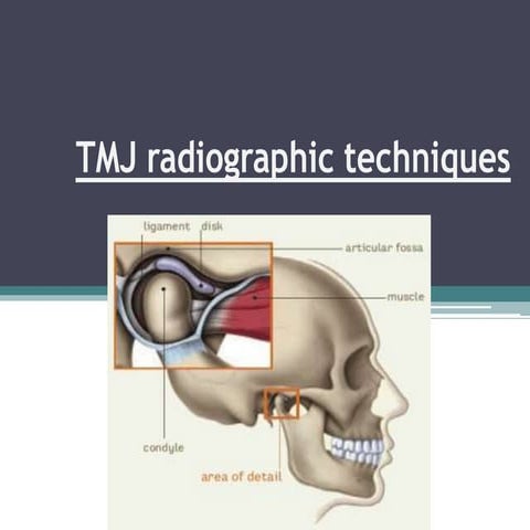 Tmj imaging techniques | PPTX