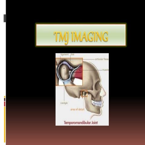 Tmj joint imaging | PPTX