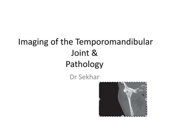 condyle disc-complex_derangement_1 | PPT