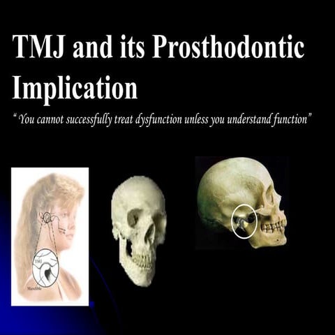 TMJ and it’s Prosthodontic Implication | PPT | Bone and Joint ...