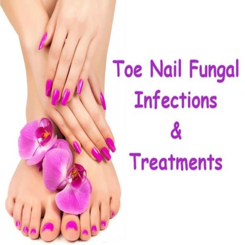 Toe Nail Fungal Infections & Treatments | PDF