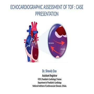 Tetralogy of Fallot (TOF) | PPTX