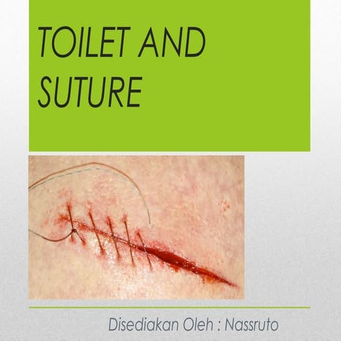 TOILET AND SUTURE | PPT