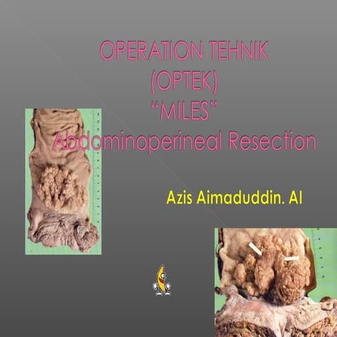Ca recti Miles operation Abdominalperinealresection | PPT