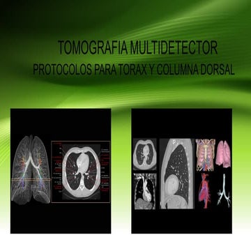 TOMOGRAFIA COMPUTADA MULTIDETECTOR. TX.pptx
