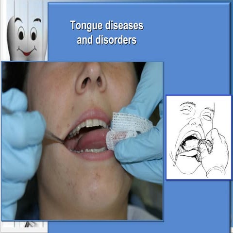 Tongue lecture | PPT